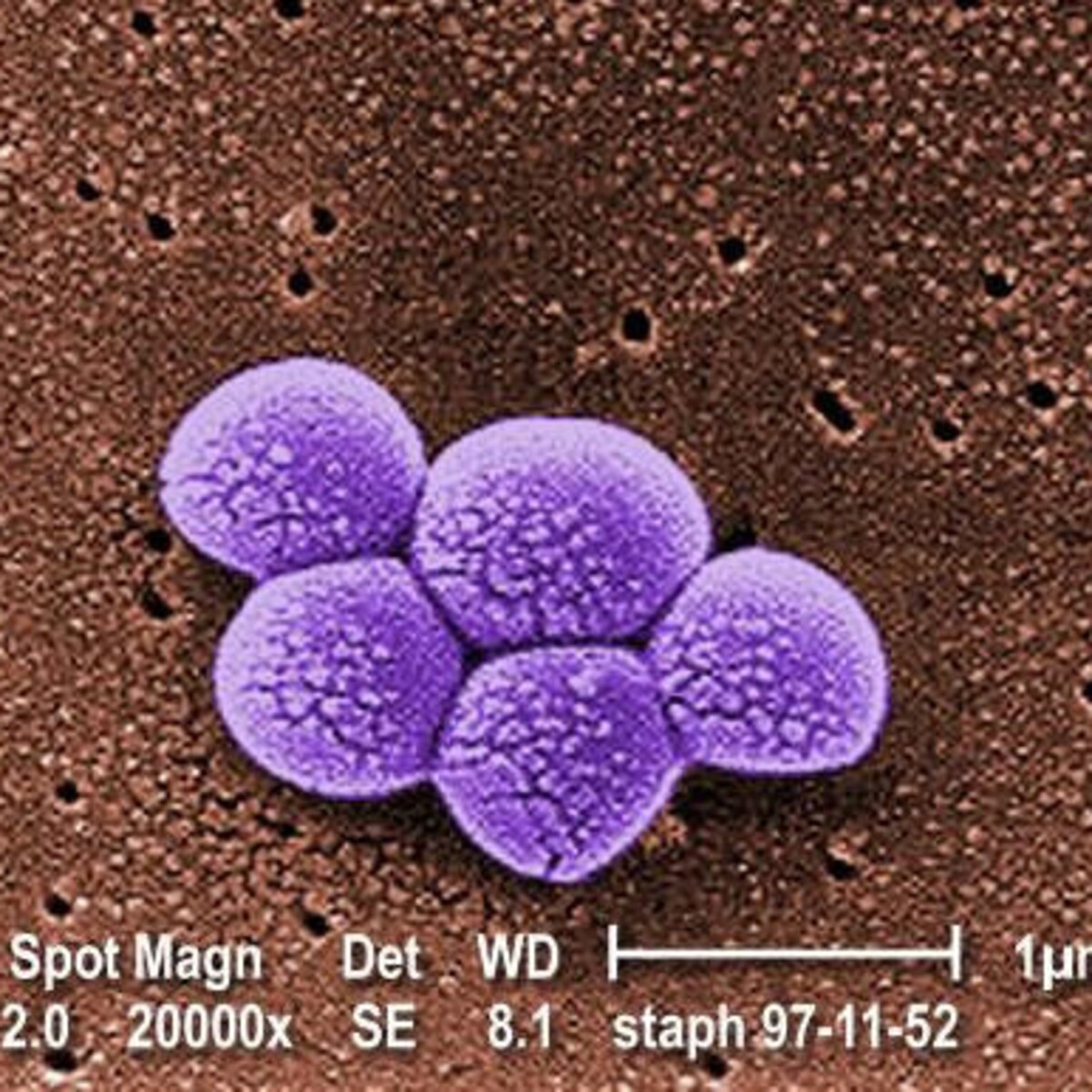 Mrsa Bakterien