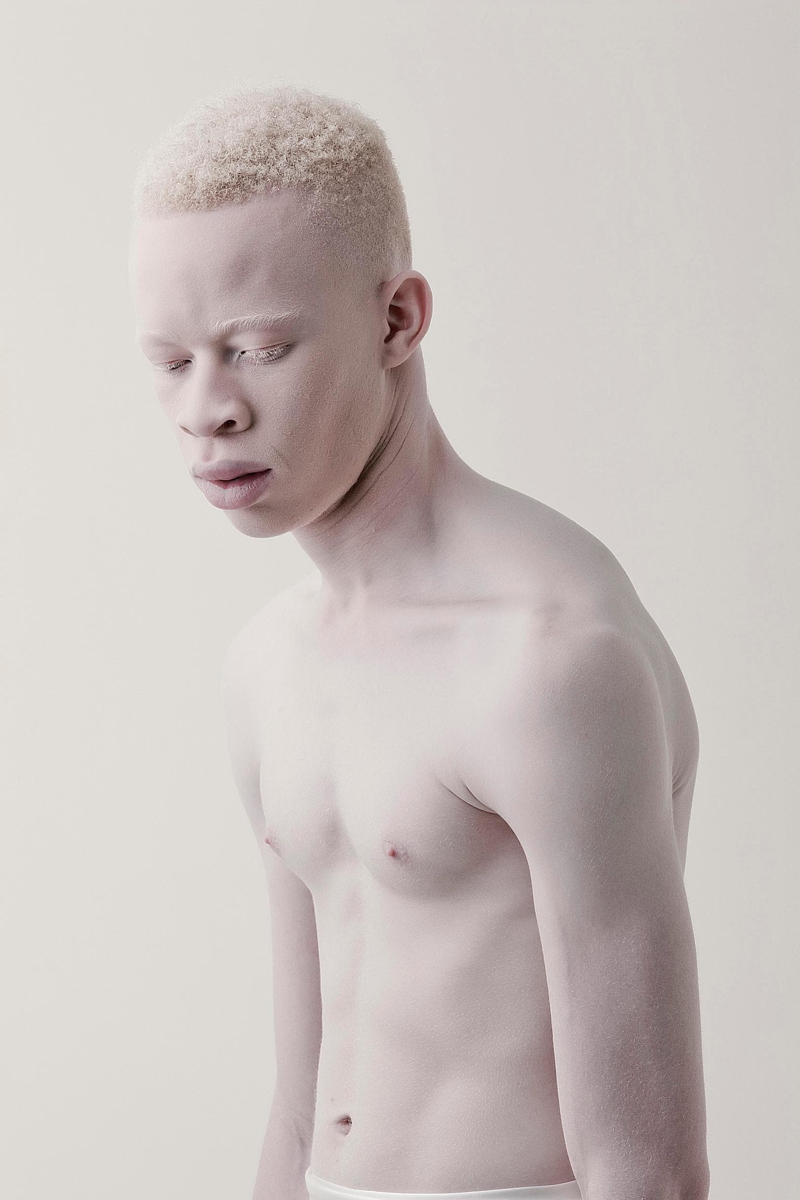 Model Sanele Xaba wil af van taboe op albinisme | Het Parool