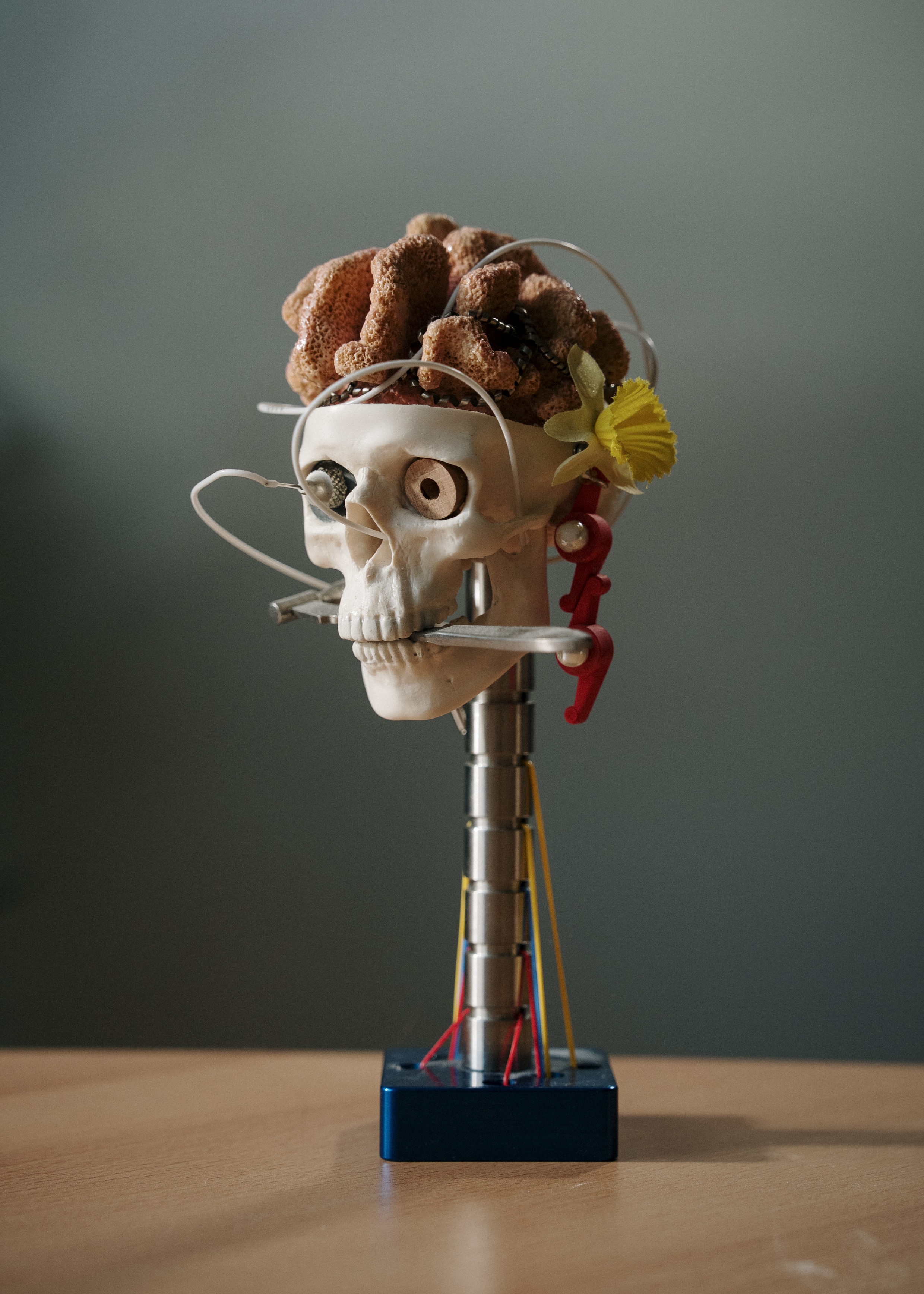 Neurochirurg Mariam Slot (42) kan patiënt live laten meepraten tijdens ...