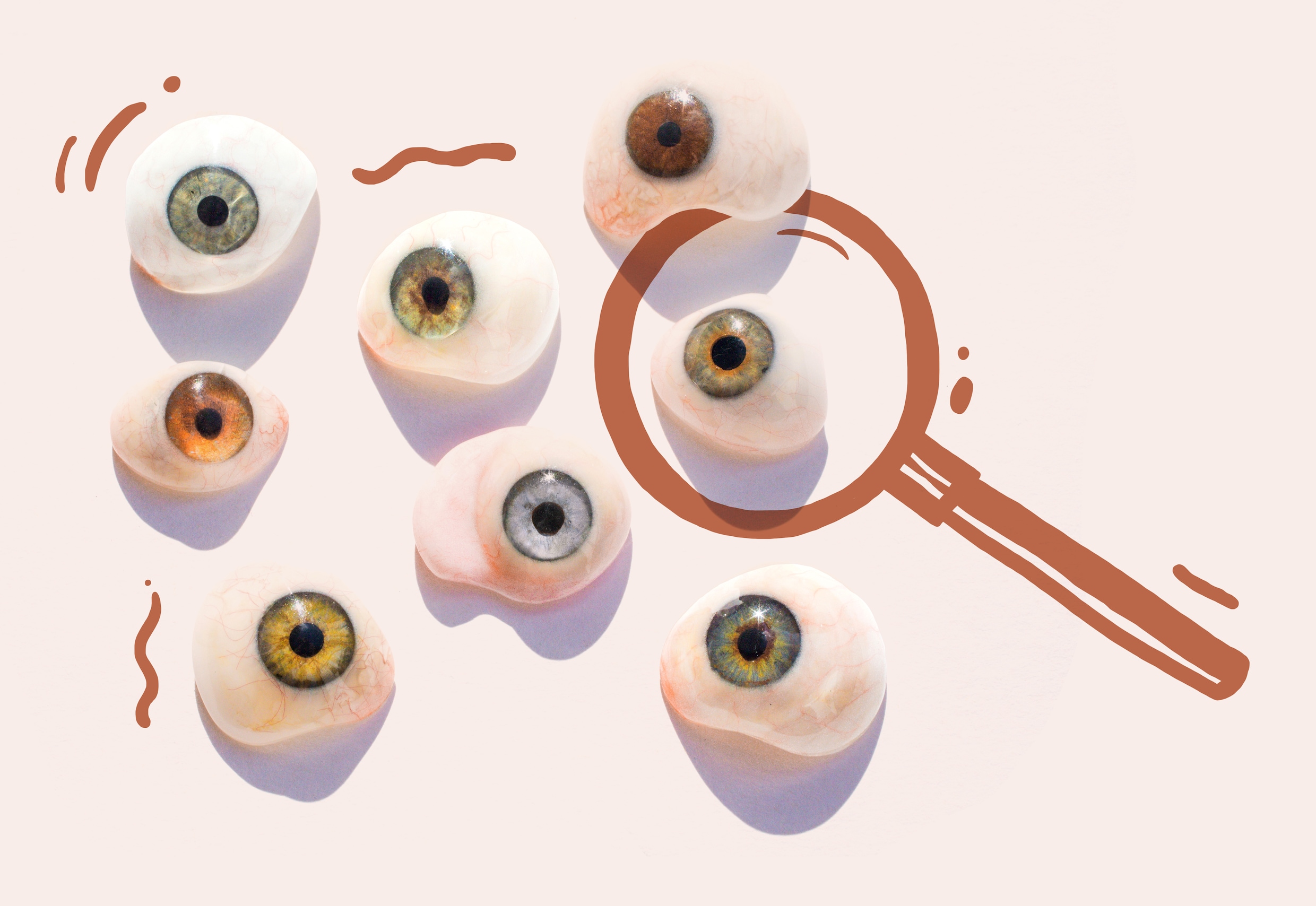 Na de tanden moeten de ogen er ook aan geloven: hoe erg is het als het ...